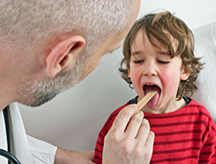 Angine - Complications | Medipedia