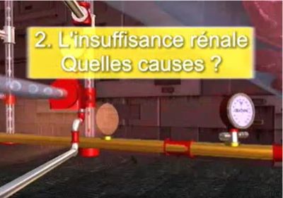 Insuffisance rénale - Quelles sont les causes de l'insuffisance rénale ...
