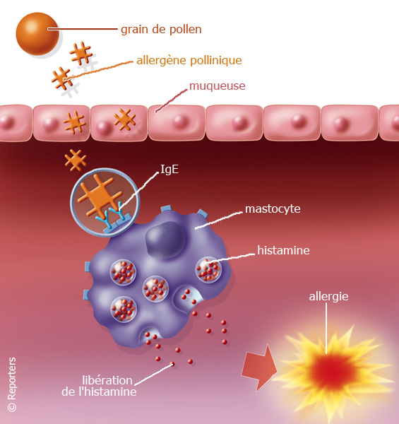 Allergische rhinitis | Medipedia