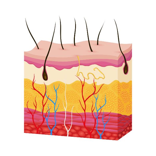 Soins de plaies - Qu’est-ce qu’une plaie? | Medipedia