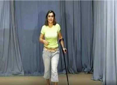 Spasticité - Spasticité sévère: impact sur la marche | Medipedia